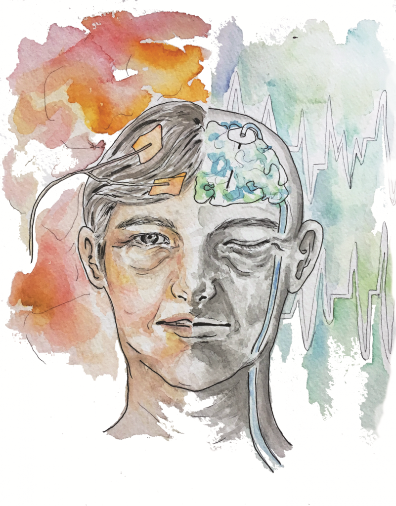 Non Invasive Deep Brain Stimulation